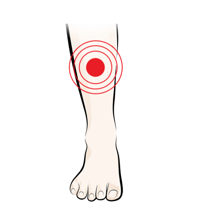 Buy Inserts/Insoles for Shin Splints Online in India (Orthotics)